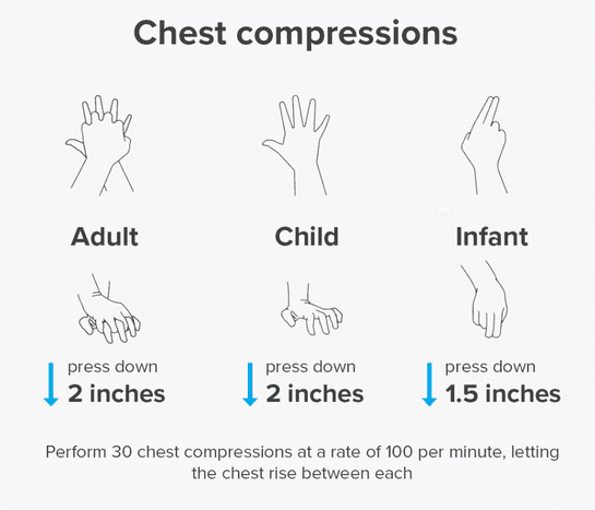 CPR یا احیا در بالغین - Inside Health Zone اصول احیا CPR در بالغین